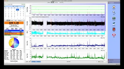 OSCAR: (the Open Source CPAP Analysis Reporter) is | AlternativeTo