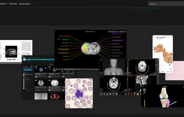 IMAIOS: Anatomy and Medical Imaging: Revolutionizing Healthcare ...