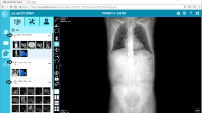 postDICOM - Free DICOM Viewer: Reviews, Features, Pricing & Download | AlternativeTo