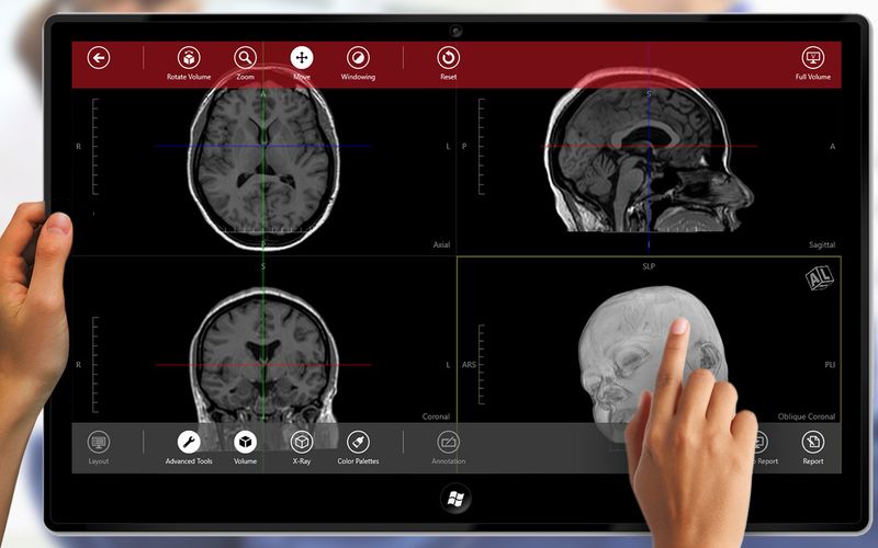 DICOMan Alternatives: Top 10 DICOM Viewers & Similar Apps | AlternativeTo