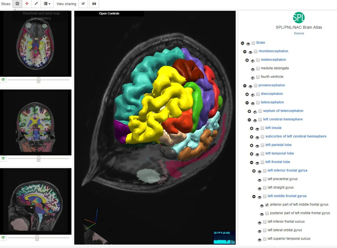 Open Anatomy: The Open Anatomy Project is an ambitious project to fundamentally change the ...