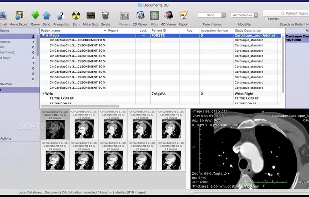 DICOMan Alternatives: Top 10 DICOM Viewers & Similar Apps | AlternativeTo