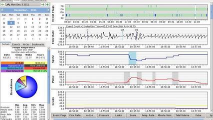 OSCAR: (the Open Source CPAP Analysis Reporter) is | AlternativeTo
