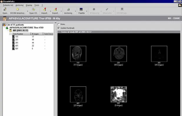 Horos Alternatives for Windows: Top 10 DICOM Viewers & Similar Apps ...