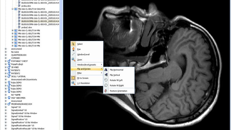 MicroDicom: Pplication for primary processing | AlternativeTo
