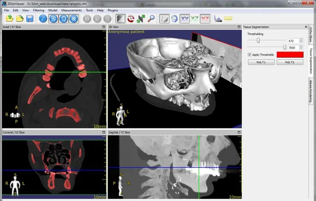 Horos Alternatives for Windows: Top 19 DICOM Viewers & Similar Apps ...