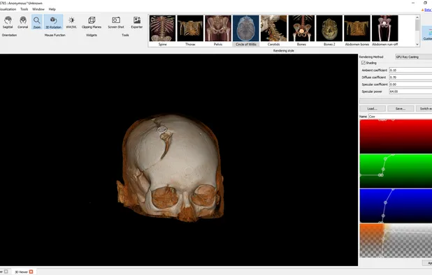 Starviewer: DICOM medical imaging viewer | AlternativeTo