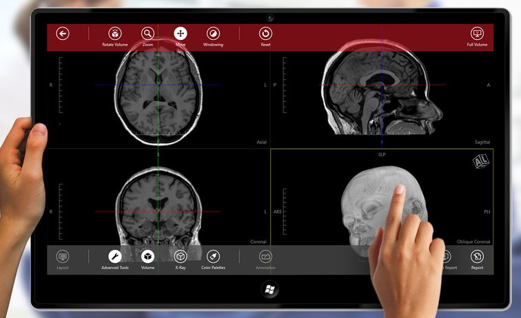 DICOM Viewers | AlternativeTo