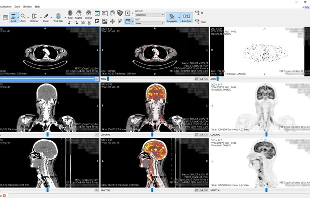 Starviewer: DICOM medical imaging viewer | AlternativeTo