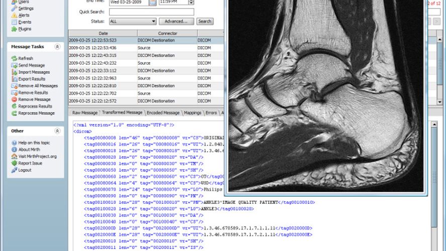 Mirth Connect: Cross-platform HL7 interface engine that enables bi ...