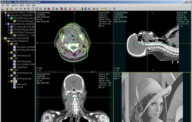 Horos Alternatives for Windows: Top 19 DICOM Viewers & Similar Apps ...