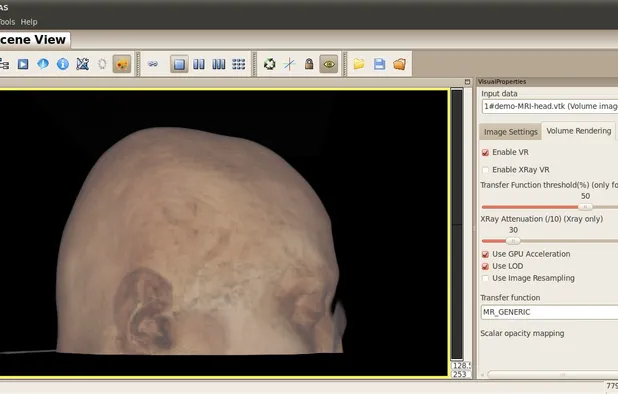 Horos Alternatives for Windows: Top 19 DICOM Viewers & Similar Apps ...