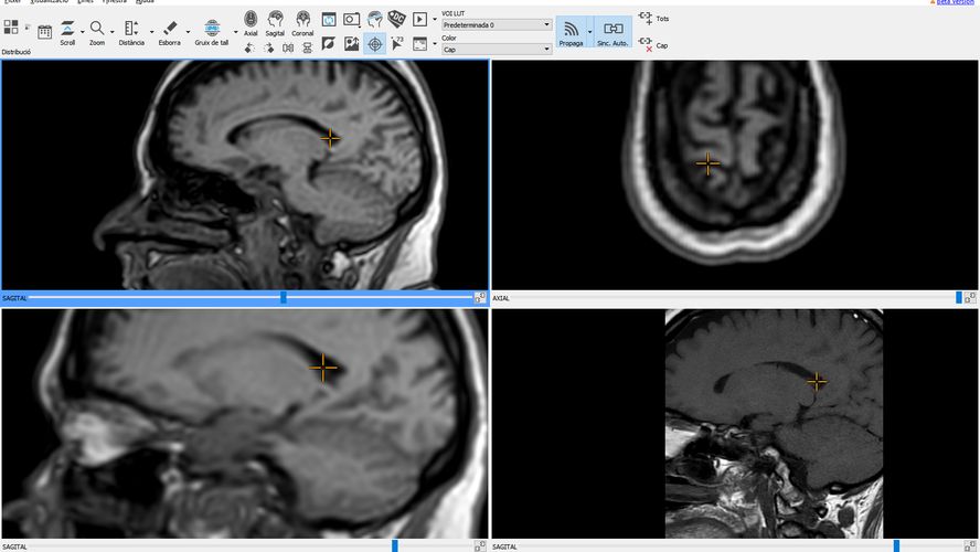 Starviewer: DICOM medical imaging viewer | AlternativeTo