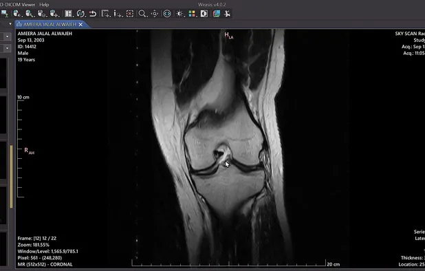 Weasis: Multipurpose standalone and web-based DICOM viewer | AlternativeTo