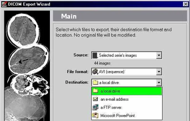 DICOMan Alternatives: Top 10 DICOM Viewers & Similar Apps | AlternativeTo