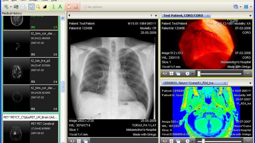 RadiAnt DICOM Viewer Alternatives: Top 10 DICOM Viewers & Similar Apps ...