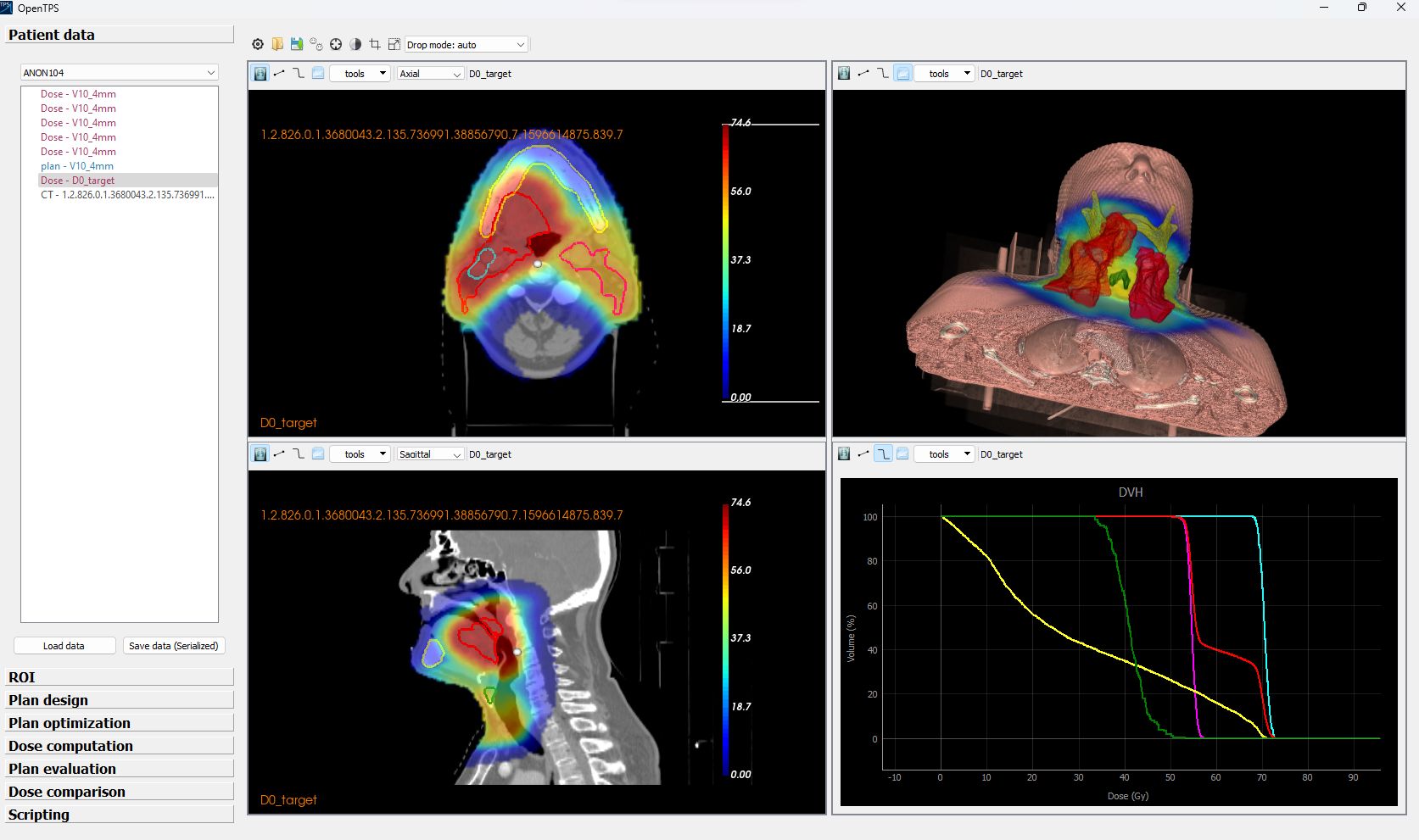 OpenTPS: Open-source treatment planning system (TPS) for research in ...