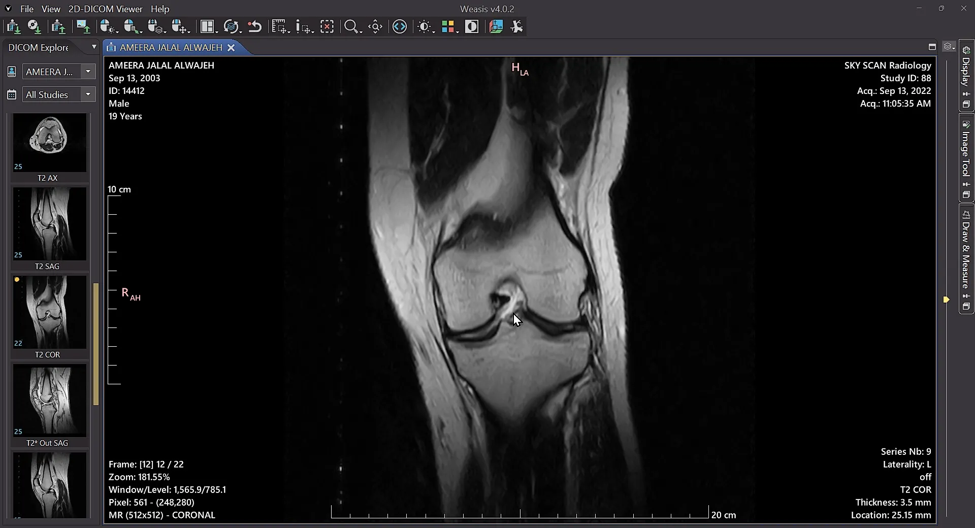 Weasis: Multipurpose standalone and web-based DICOM viewer | AlternativeTo