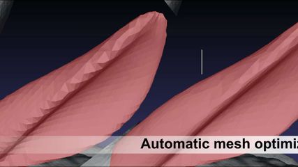 MeshLab: System for processing and editing 3D triangular meshes ...