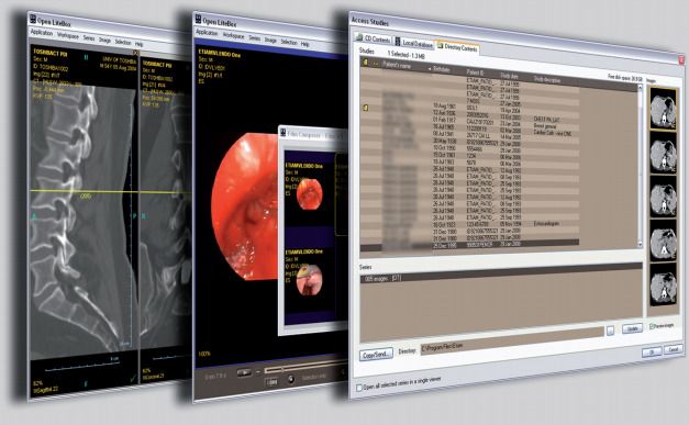 Open LiteBox Alternatives: Top 10 DICOM Viewers & Similar Apps ...
