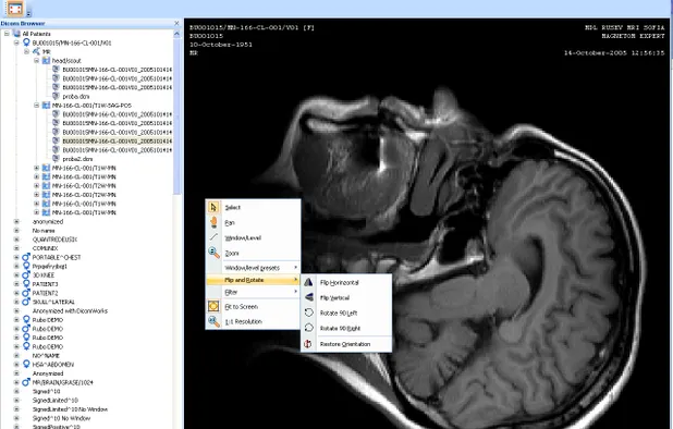 MicroDicom: Pplication for primary processing | AlternativeTo