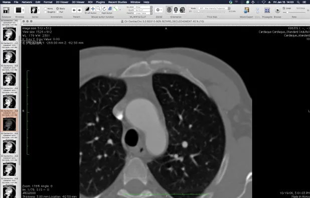 RadiAnt DICOM Viewer Alternatives: Top 12 DICOM Viewers & Similar Apps ...