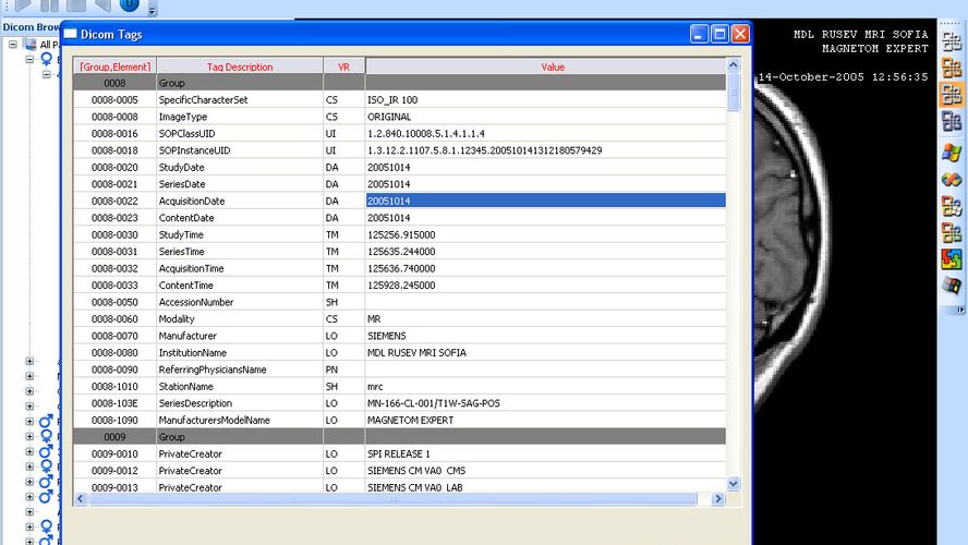 MicroDicom: Pplication for primary processing | AlternativeTo