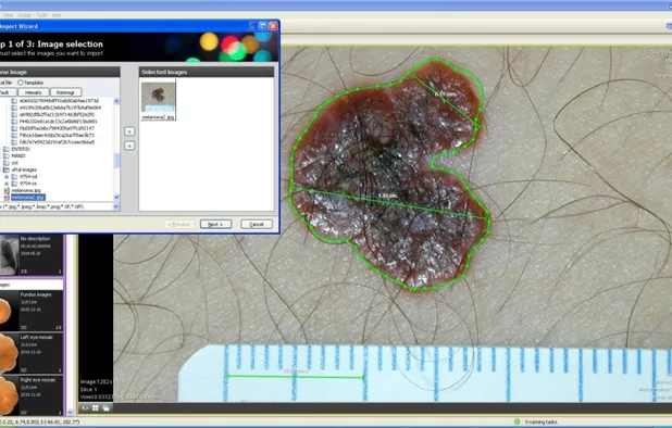 RadiAnt DICOM Viewer Alternatives: Top 10 DICOM Viewers & Similar Apps ...
