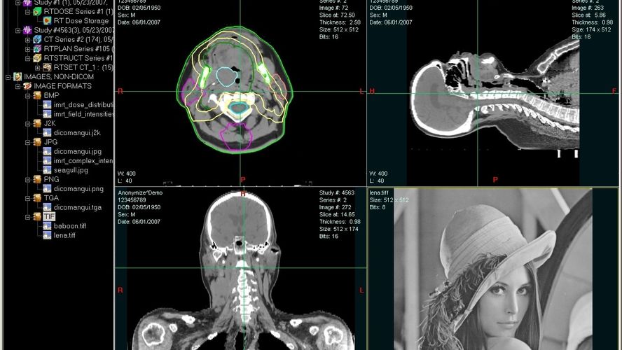 DICOMan: All-In-One DICOM Wizard for Radiation Oncology | AlternativeTo